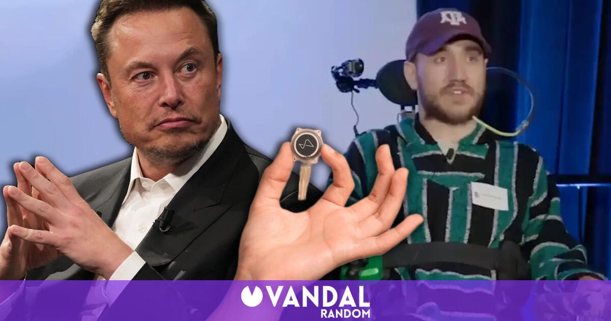 El Primer Implante De Neuralink De Elon Musk Está Presentando Fallos