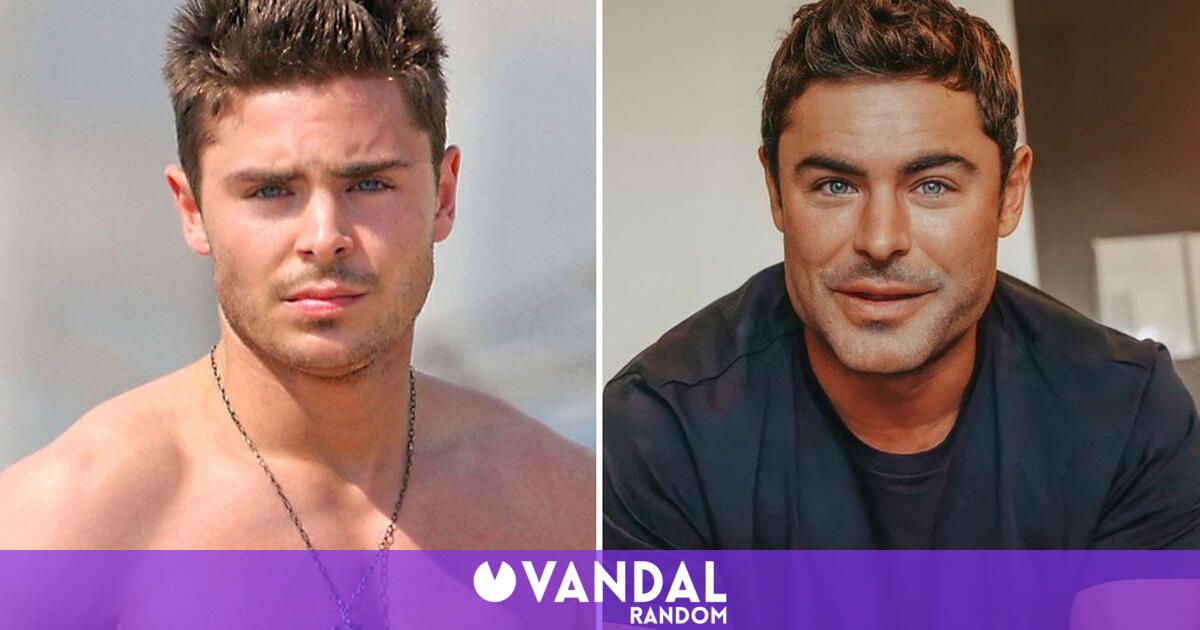 Zac Efron 'casi muere' tras el accidente que le deformó la cara ... Zac Efron 'casi muere' tras el accidente que le deformó la cara ...